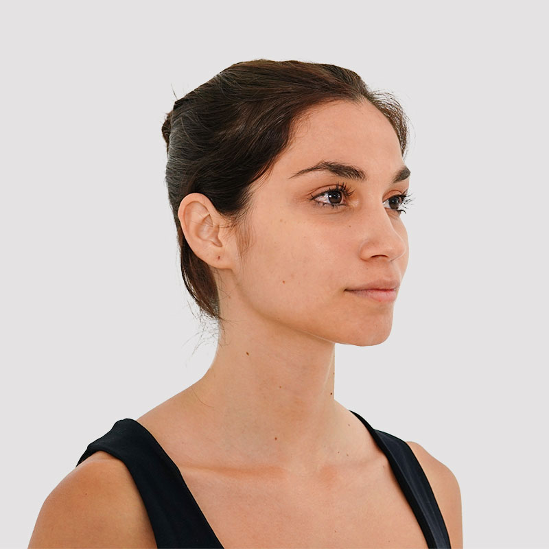 Crisalix | VR 4D & 3D plastic & cosmetic surgery simulator software